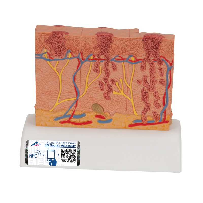 3B Scientific Magnified Skin Cancer Model | Health and Care